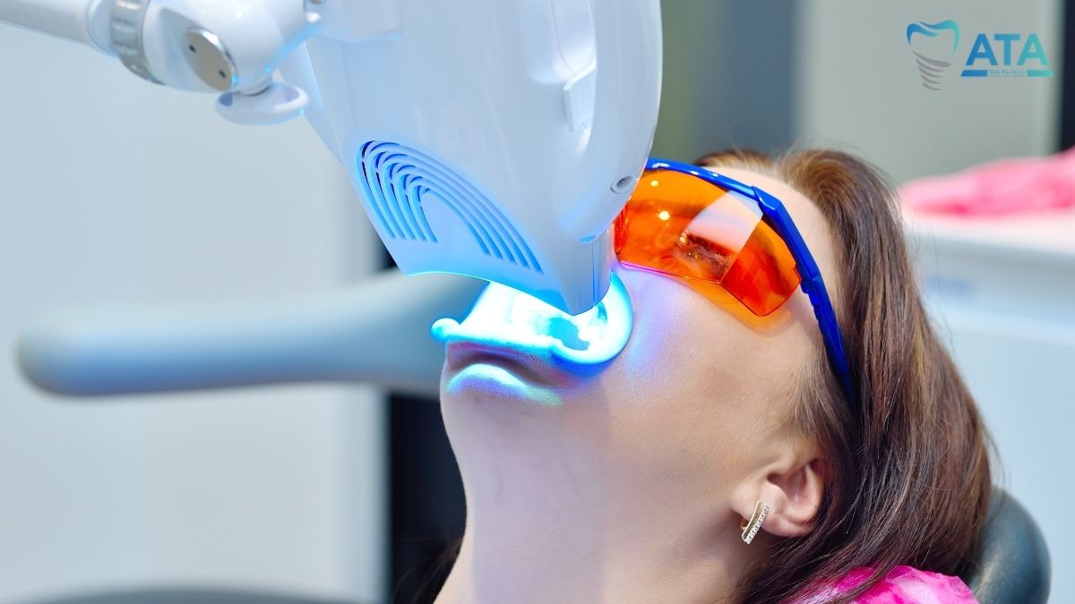 Teeth Whitening and Bleaching in Turkey - Ata Dental Clinic