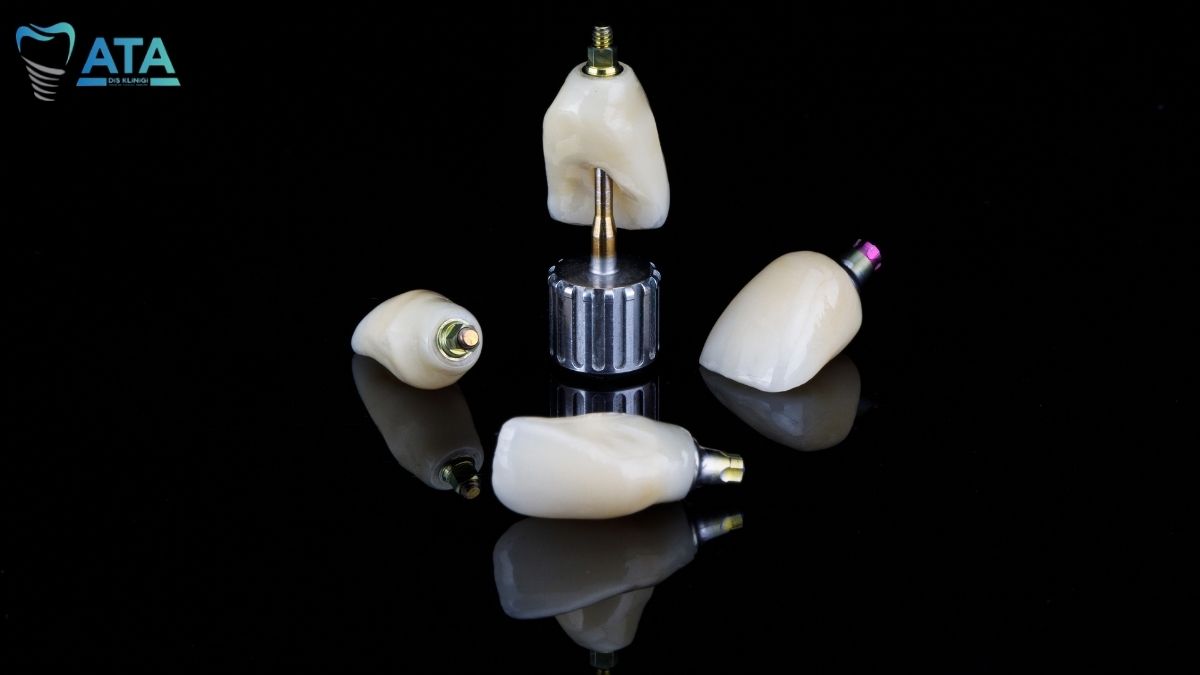 Monolithic Zirconia Crown in Turkey- Cost, Reviews | Ata Dental